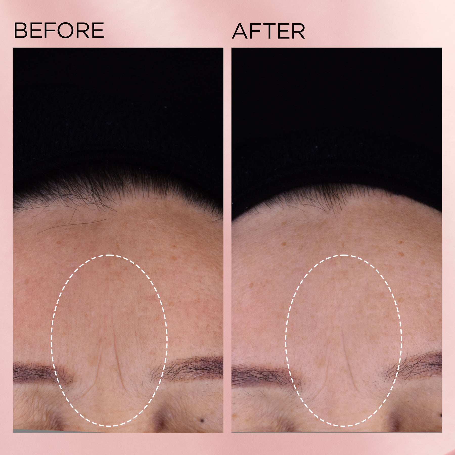 Discover: NEW Retinol HPR Ceramide Capsules Serum | Elizabeth Arden UK