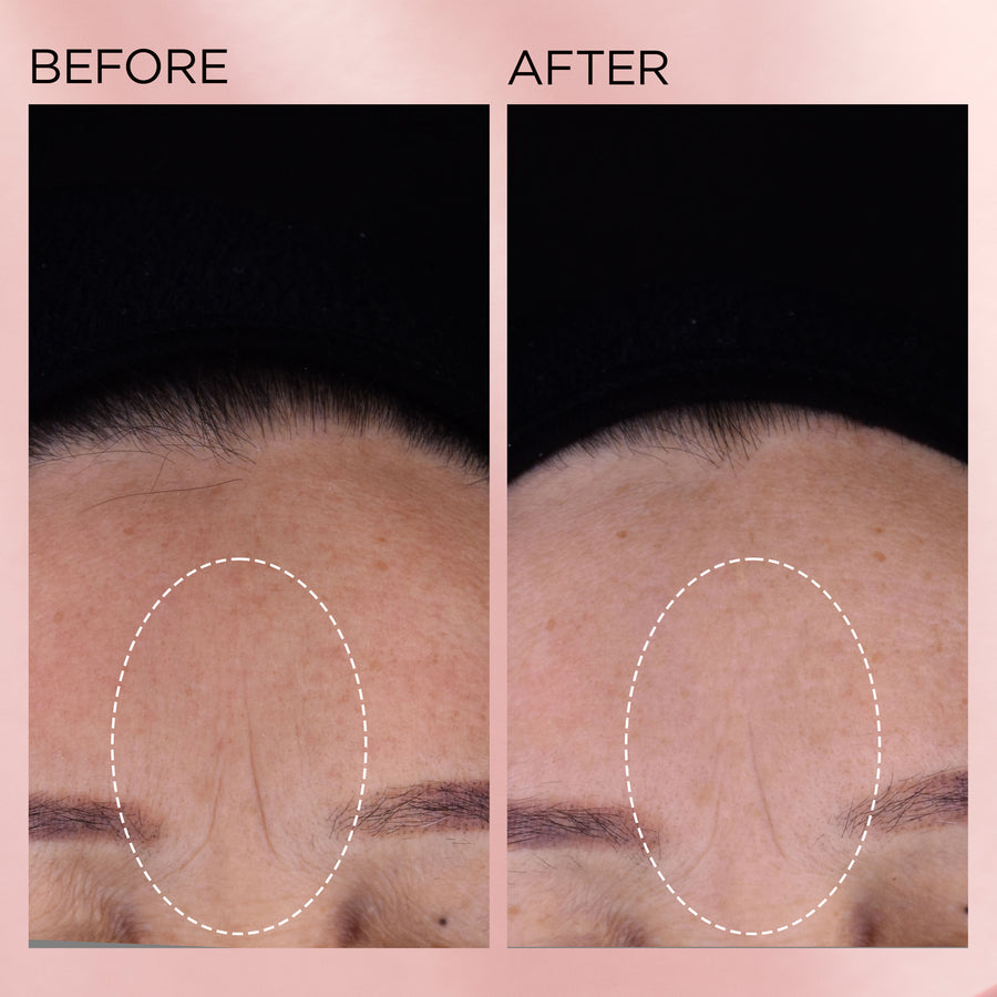 Discover: NEW Retinol HPR Ceramide Capsules Serum | Elizabeth Arden UK