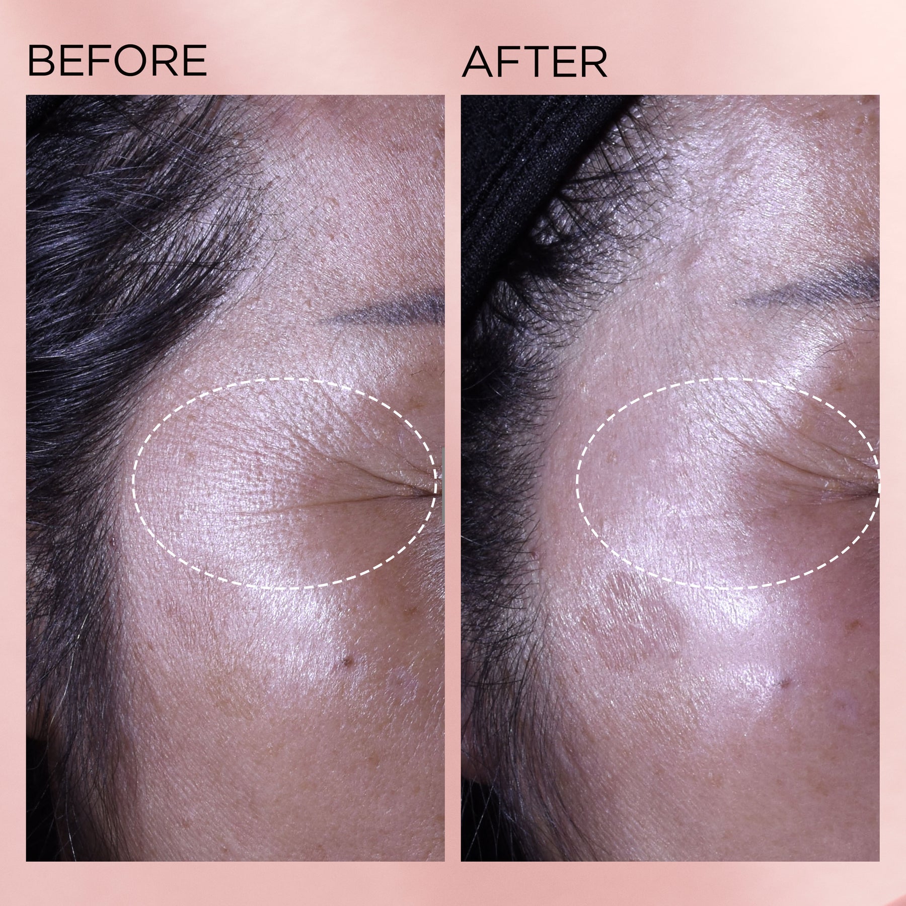 Discover: NEW Retinol HPR Ceramide Capsules Serum | Elizabeth Arden UK