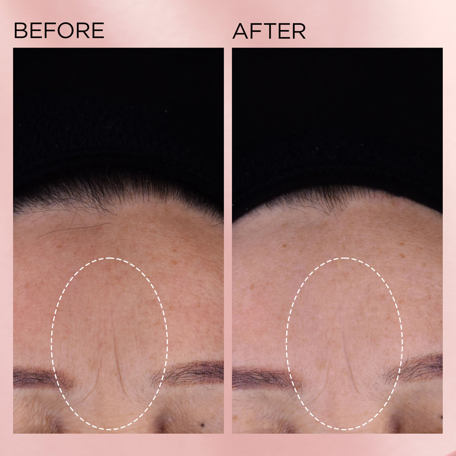 Discover: NEW Retinol HPR Ceramide Capsules Serum | Elizabeth Arden UK