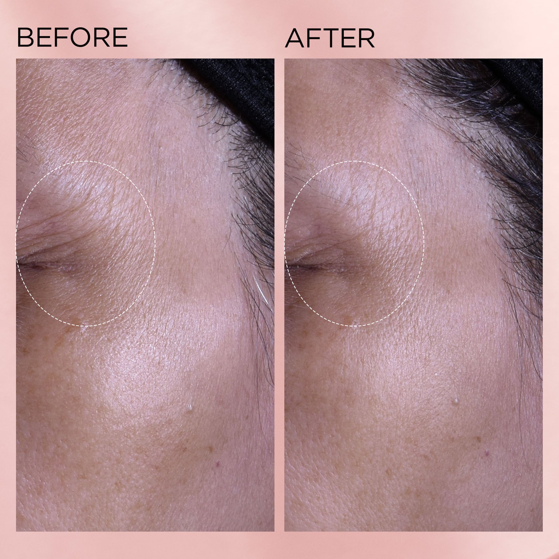 Retinol + HPR Ceramide Rapid Skin-Renewing Water Cream | Elizabeth Arden UK