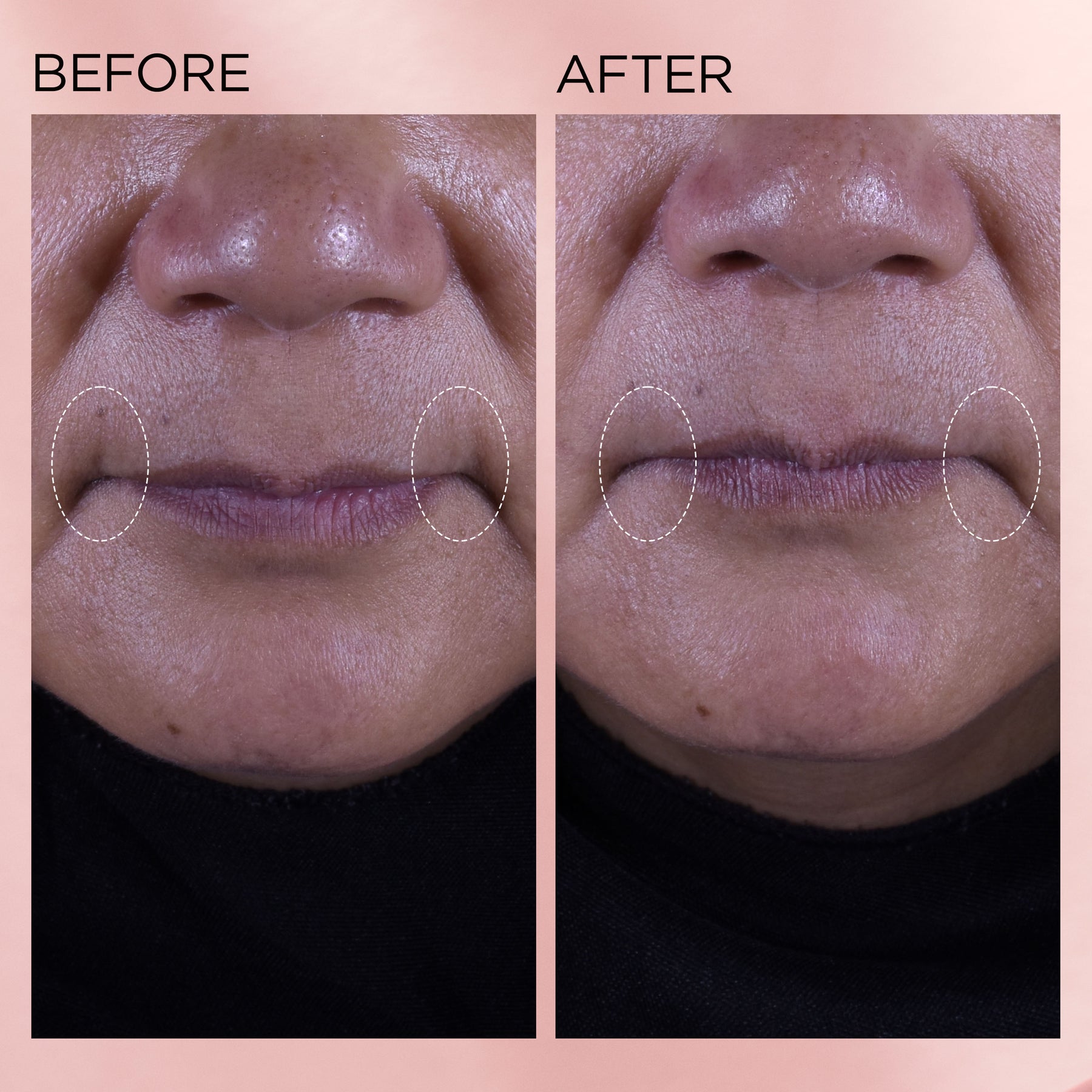 Retinol + HPR Ceramide Rapid Skin-Renewing Water Cream | Elizabeth Arden UK