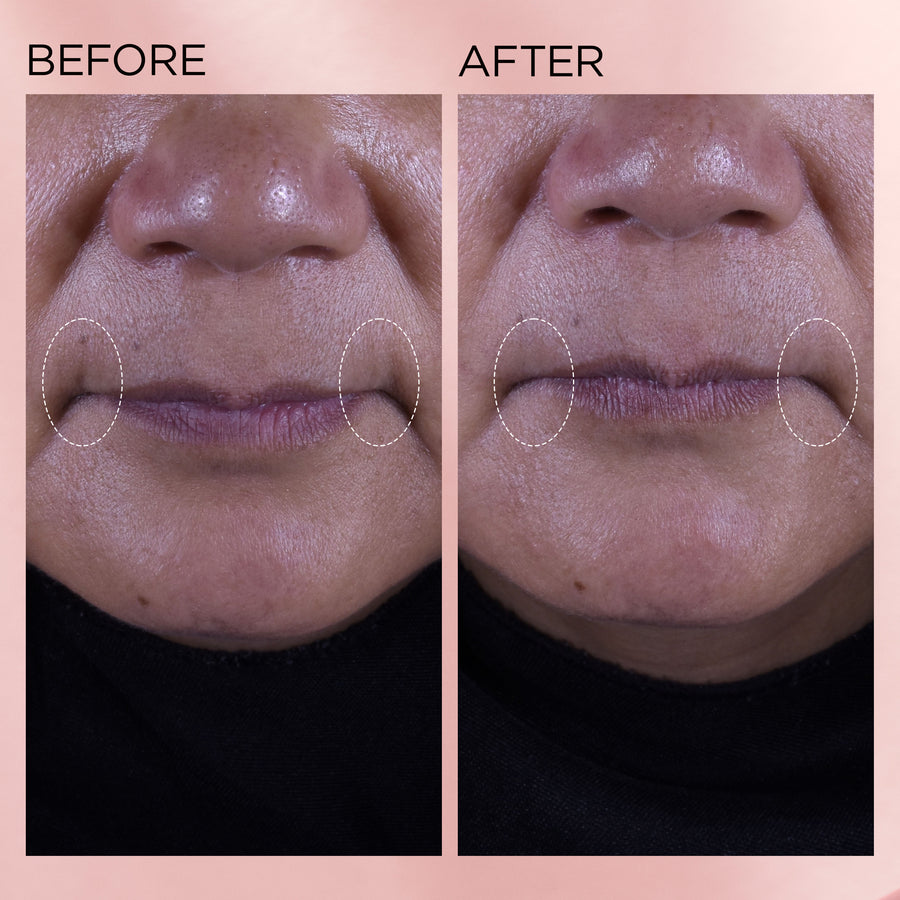 Retinol + HPR Ceramide Rapid Skin-Renewing Water Cream | Elizabeth Arden UK